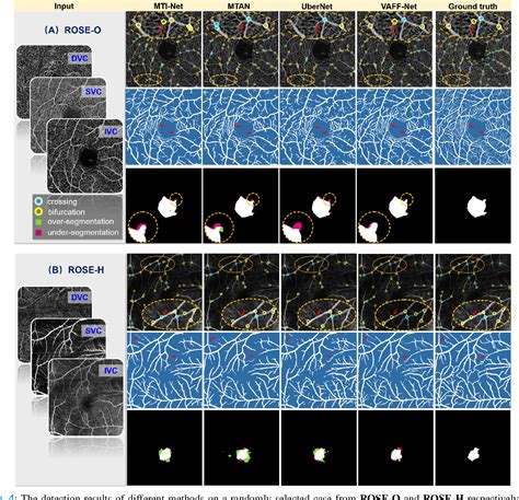 Retinal Structure Detection In Octa Image Via Voting Based Multi Task