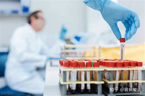 降低血肌酐的5种药物方案全览，保护肾功能才是关键 知乎