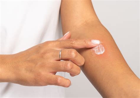 How To Patch Test Skincare Pillowtalkderm Dr Idriss