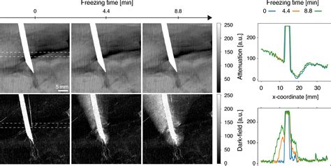 X Ray Dark Field Computed Tomography For Monitoring Of Tissue Freezing Professur Für Physik