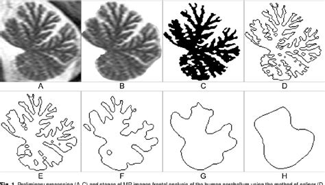 Figure 1 From Fractal Dimension Of External Linear Contour Of Human