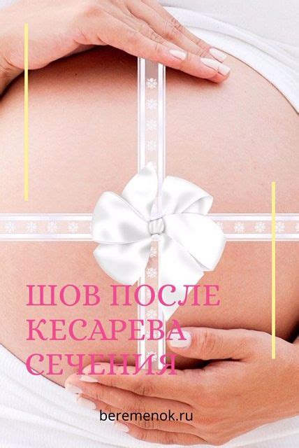 Шов после кесарева сечения в 2020 г | Подготовка к родам, Роды, Советы ...