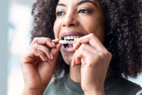 Unlocking Confident Smiles A Comprehensive Guide To Modern Teeth