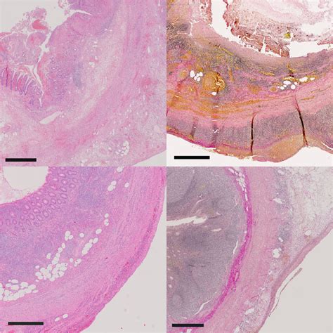 Low Power Views Of Complicated Upper Row And Uncomplicated Download Scientific Diagram