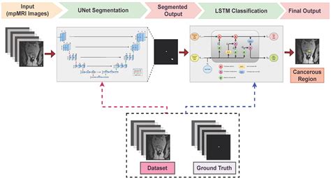 Automated Diagnosis Of Prostate Cancer Using Mpmri Images A Deep Learning Approach For Clinical