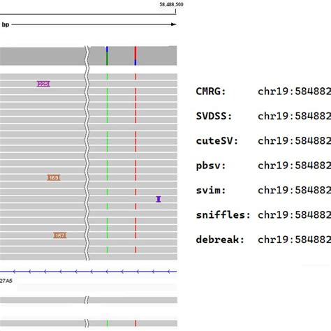 Example Of An Sv At A Medically Relevant Gene That Has Been Correctly Download Scientific