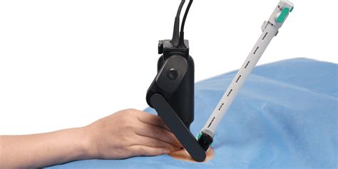 Fda Clears Handheld Robotic System For Ultrasound Guided Needle Placement