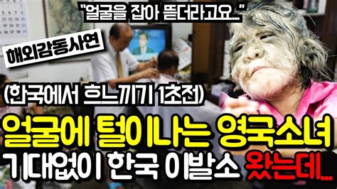 10년 동안 얼굴에 머리카락이 자라나는 희귀병을 가지고 살아온 영국 소녀 기대 없이 한국 이발소 왔다가 1초 만에 오열하며 뛰쳐나간 이유 Youtube
