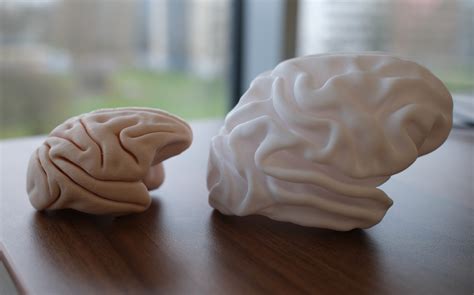Topographical Distribution Of Auditory Sources In Meg Vs Eeg