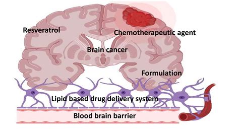 Brain Cancer Chemotherapy