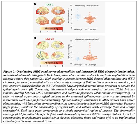 Interictal Meg Abnormalities To Guide Intracranial Electrode Implantation And Predict Surgical