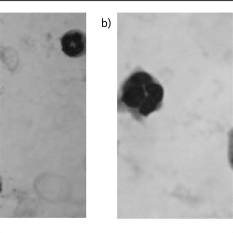 Morphological Analysis Of Neutrophils Stained With Leishman Staining
