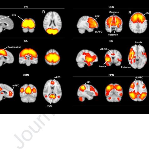 Ica Results Of Intrinsic Brain Networks Note Cen Central Executive Download Scientific
