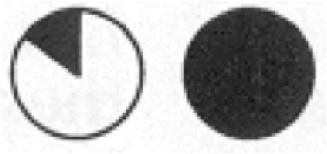 Visual Field Mejico Lecture Flashcards Quizlet