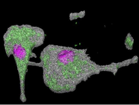 Sars Cov 2 Persistence A Focus On Natural Killer Cell And Macrophage Dynamics Polybio Research