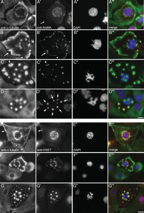 Figure 6 From Live Cell Analysis Of Mitotic Spindle Formation In Taxol