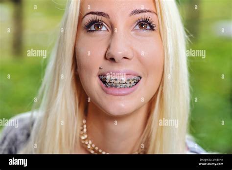 in this portrait of a smiling girl the two rows of teeth with braces