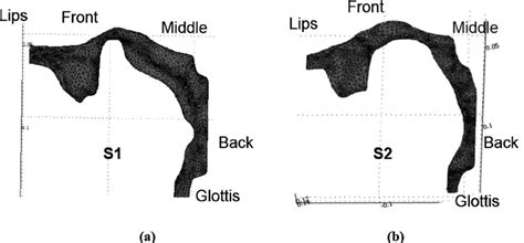 Fem Mesh Of The Reconstructed 3d Vocal Tract ͑ A ͒ The Retroflex