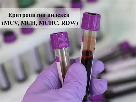 Еритроцитни индекси MCV MCH MCHC RDW ArsMedica bg