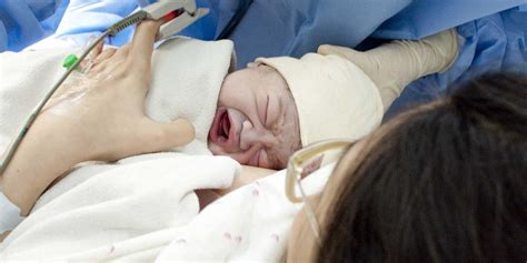 C Section Vs Normal Delivery Delivery Decisions What All You Need To Know Cloudnine Blog