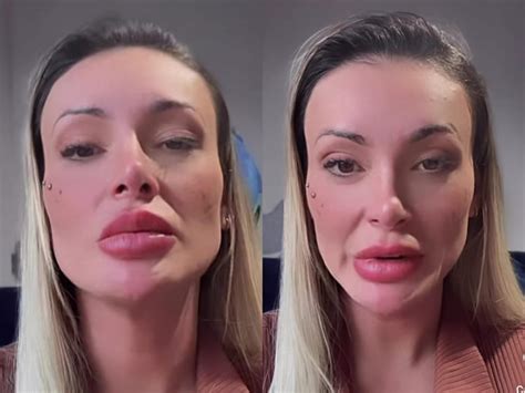Andressa Urach Segue Os Passos De Maya E Muda Cor Dos Olhos Com Cirurgia Sonho Portal Leo Dias