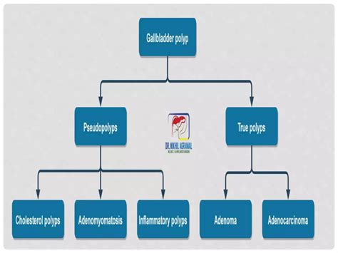 Gallbladder Polyppptx Digestive Disorders Diseases And Conditions
