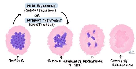 Tumour Regression Mypathologyreport Ca