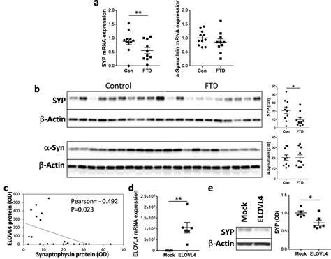Dysregulation Of Synaptophysin In Ftd Brain A Mrna Expression Of