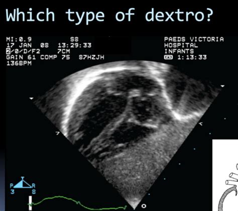 Module 1 Unit 4 Flashcards Quizlet
