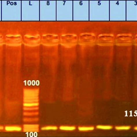 Uniplex Polymerase Chain Reaction Detection Of Structural Gene In Download Scientific Diagram