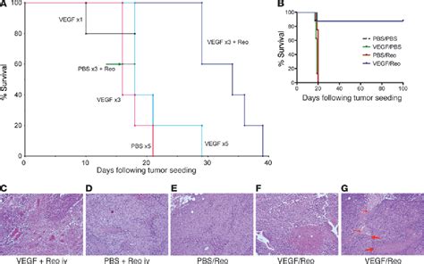 Figure 1 From Antiangiogenic Cancer Therapy Combined With Oncolytic