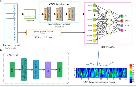 Figure 1 From A Hybrid Method For Heartbeat Classification Via