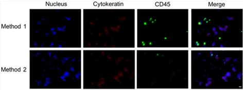 Size Selective Circulating Tumor Cell Isolation On A Centrifugal Microfluidic Device