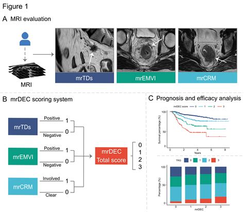 Selection Of Treatment Options For Locally Advanced Rectal Cancer An
