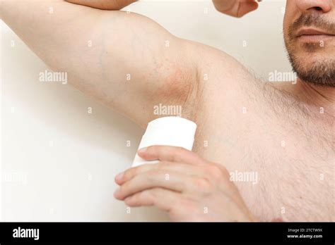 Young Man With Irritation Inflammation On Sensitive Underarm Skin