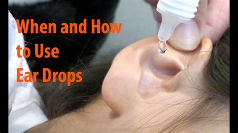 Are Ear Drops Supposed To Come Out The 15 Latest Answer