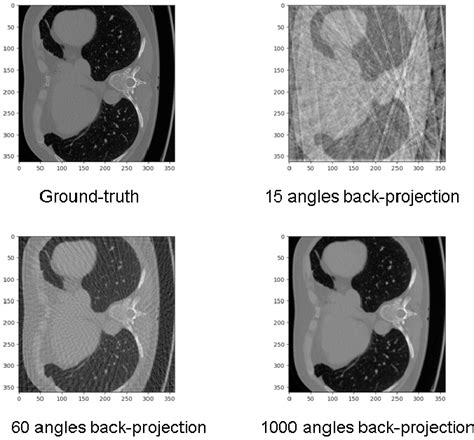 figure 1 from a novel design of industrial real time ct system based on