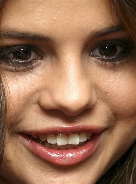 Selena Gomez Teeth Fix