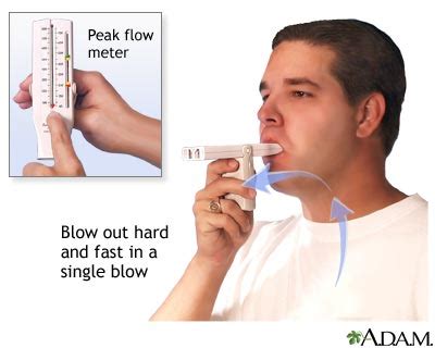 How To Use Your Peak Flow Meter Information Mount Sinai New York