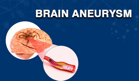 Brain And Spine Surgery Delhi Sushrut Brain And Spine