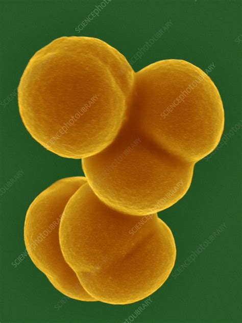 Staphylococcus Aureus Sem Stock Image C032 2055 Science Photo Library
