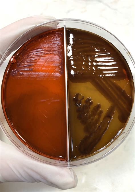 Agar Pseudomonas Aeruginosa Emb