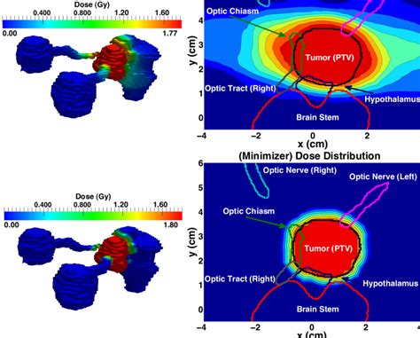 A Comparison Of The Applied Dose Distribution Top And The Minimizer Download Scientific