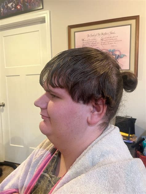 Hyperpigmentation Meme In 2025 Animal Sketches Easy Cute Drawings Easy Drawings