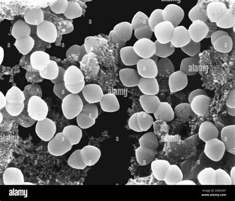 Scanning Electron Micrograph Sem Of Enterococcus Faecium Also Known
