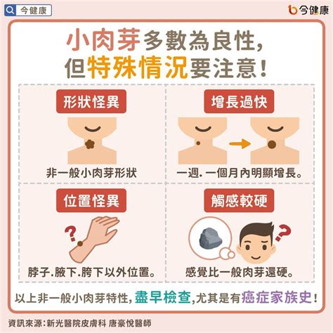 脖子、腋下的小肉芽是什麼？是腫瘤嗎？要如何消除？ 今健康
