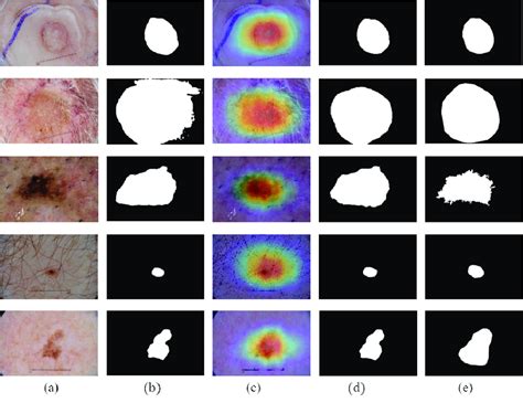 Segmentation Results Generated By The Cl Dcnn Model At Each Stage A Download Scientific