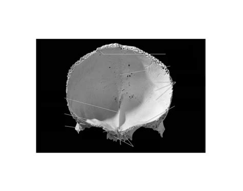 Frontal Bone Interior Quiz