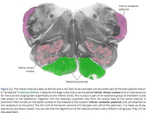 Brain Stem Cross Sections Labeled 3070 Cross Section Brain