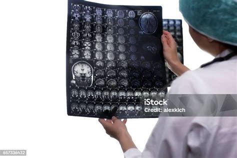 뇌 Mri 사진을 들고 있는 의사 Mri 스캔에 대한 스톡 사진 및 기타 이미지 Mri 스캔 X 레이 장비 건강관리와 의술 Istock